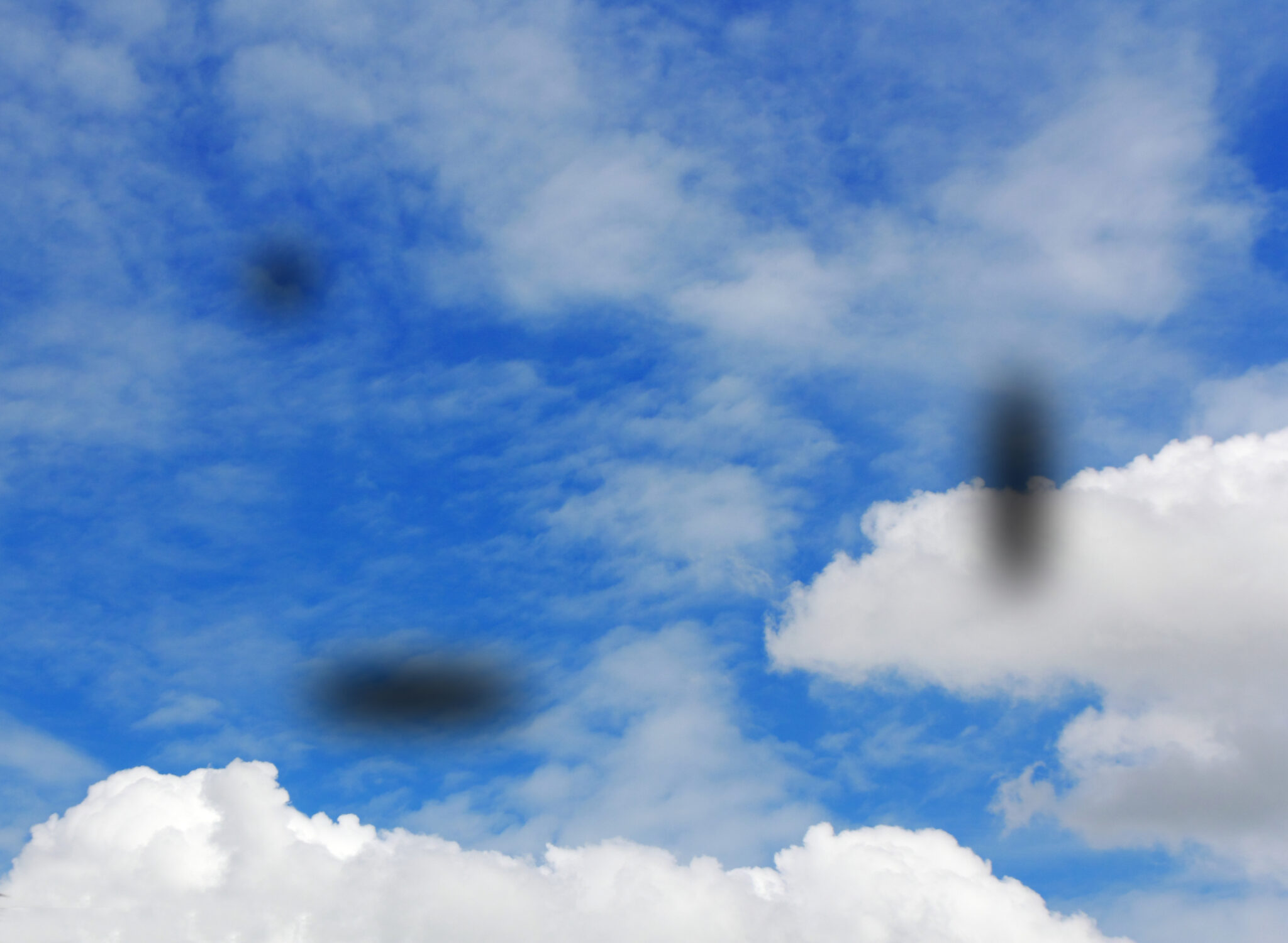 When Should You Be Concerned About Flashes and Floaters? | VisionPoint ...